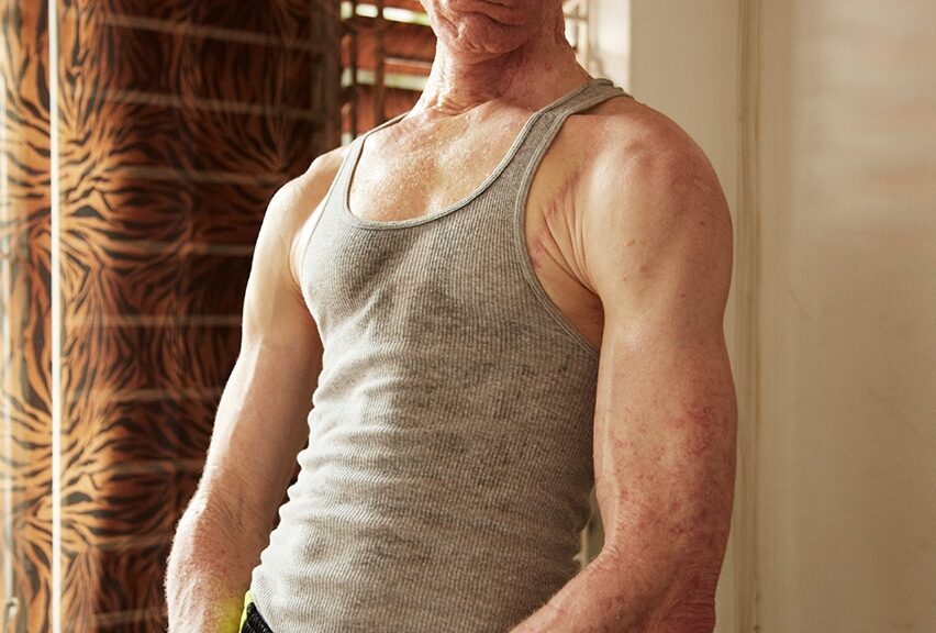 Yellowman – Reggae North